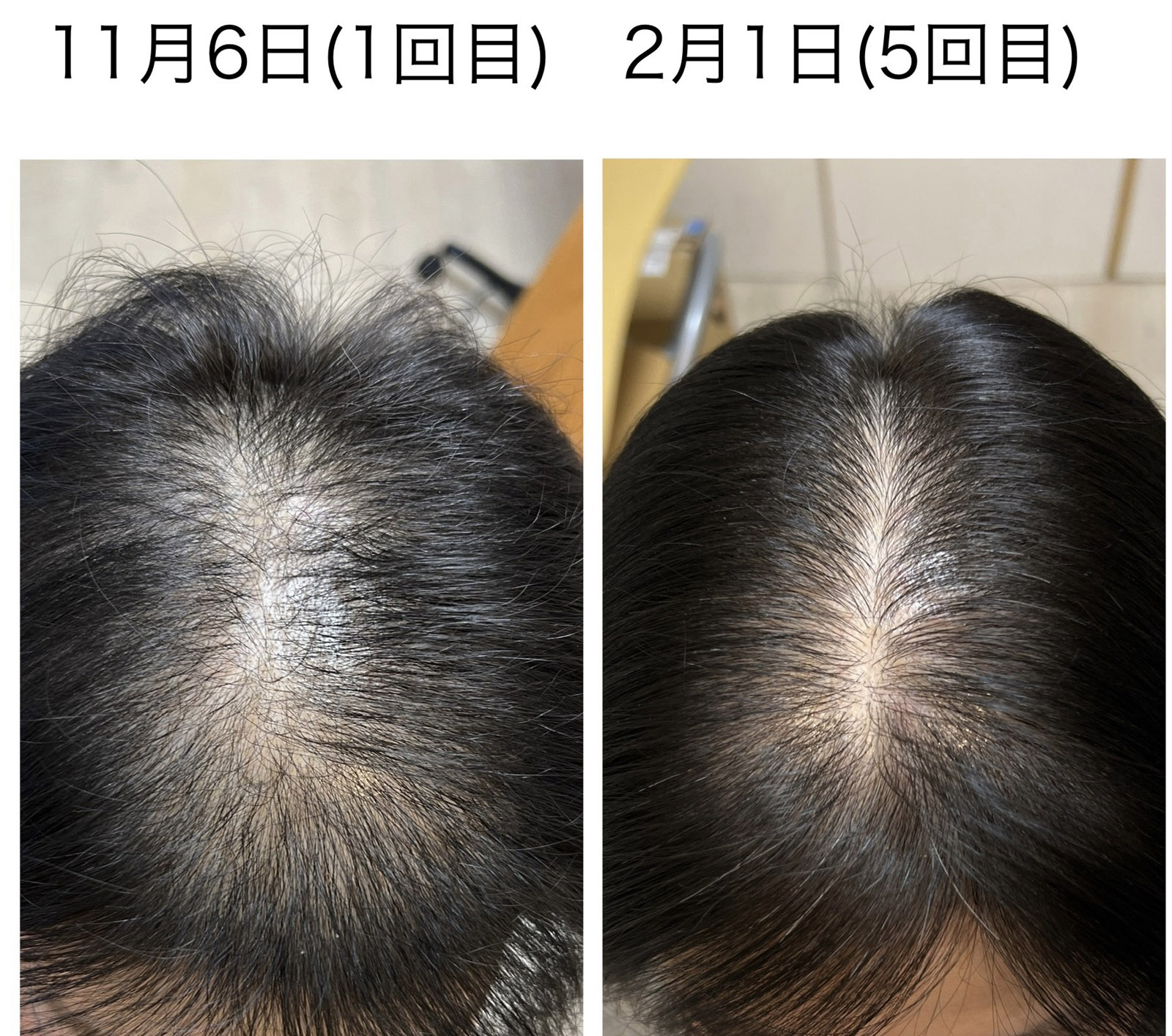 C'z hair Labo（シーズヘアーラボ） | 栗原市、登米市で美容室なら髪質改善のC'zhair（シーズヘアー）へ