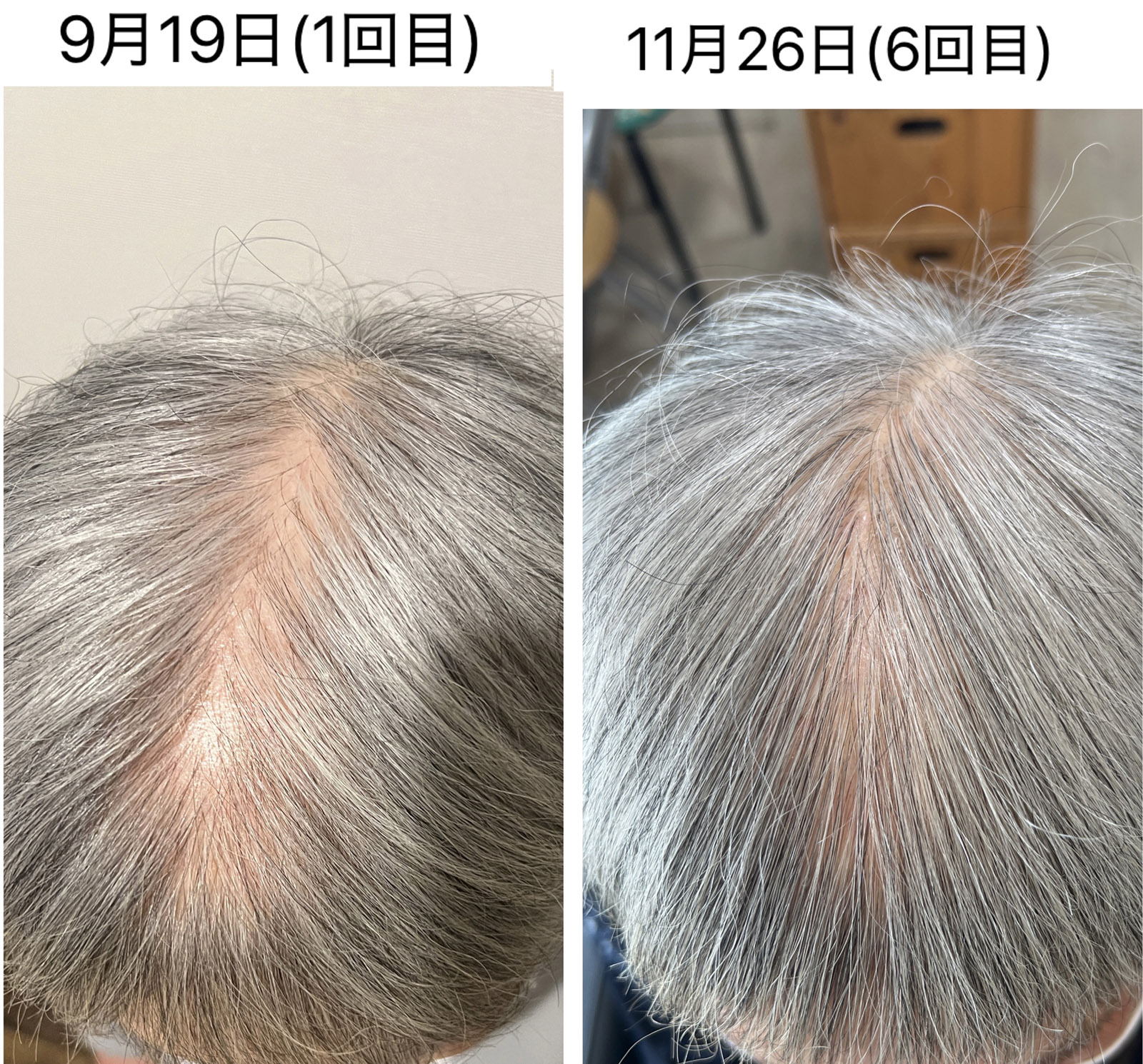 C'z hair Labo（シーズヘアーラボ） | 栗原市、登米市で美容室なら髪質改善のC'zhair（シーズヘアー）へ