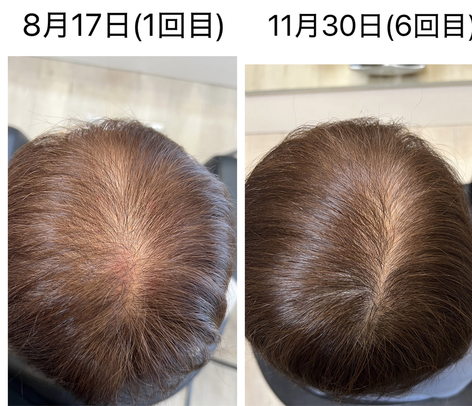 C'z hair Labo（シーズヘアーラボ） | 栗原市、登米市で美容室なら髪質改善のC'zhair（シーズヘアー）へ