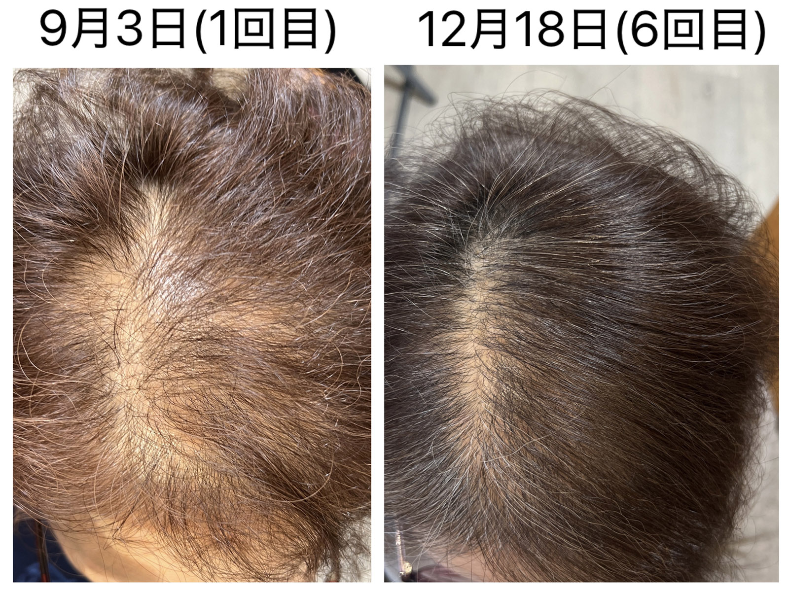 C'z hair Labo（シーズヘアーラボ） | 栗原市、登米市で美容室なら髪質改善のC'zhair（シーズヘアー）へ