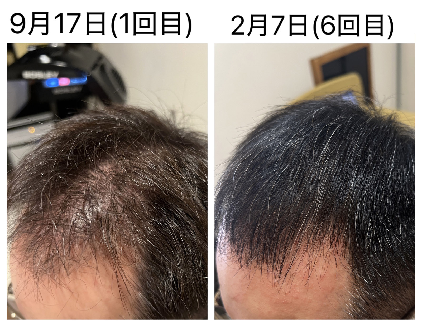 C'z hair Labo（シーズヘアーラボ） | 栗原市、登米市で美容室なら髪質改善のC'zhair（シーズヘアー）へ