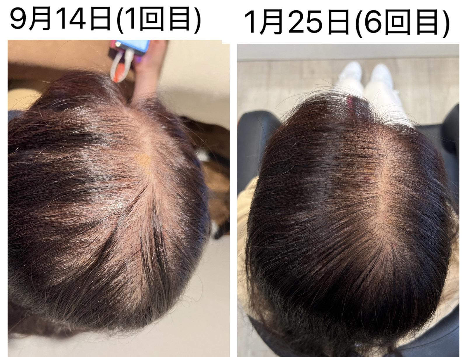 C'z hair Labo（シーズヘアーラボ） | 栗原市、登米市で美容室なら髪質改善のC'zhair（シーズヘアー）へ